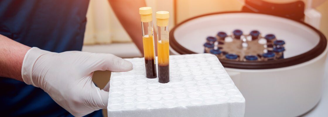 PRP Joint Injection San Diego - Oasis Health and Medicine | 858-201-3171